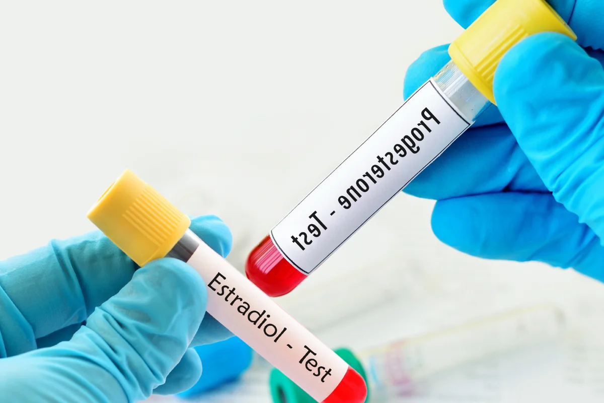 Reposição Hormonal Feminina 10 Mitos E Os Benefícios